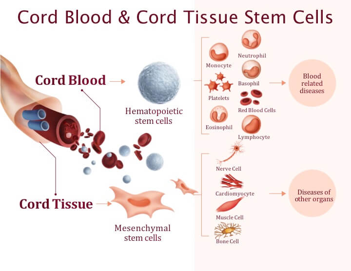 Exploring the Differences Cord Blood vs Cord Tissue - Securicord